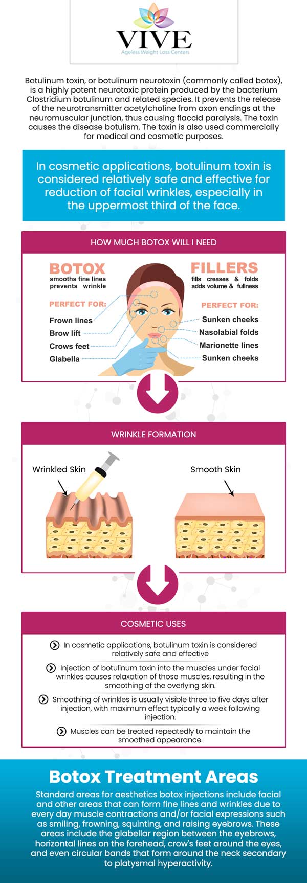 What Can Botox Do for My Look? | Vive Ageless Weight Loss